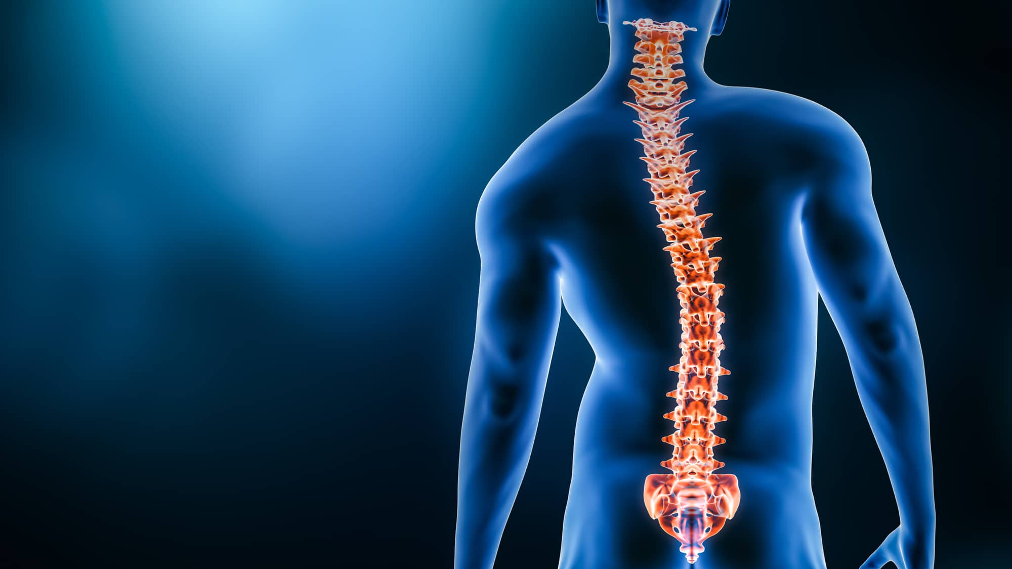 5 exercices scoliose pour corriger le dos à la maison